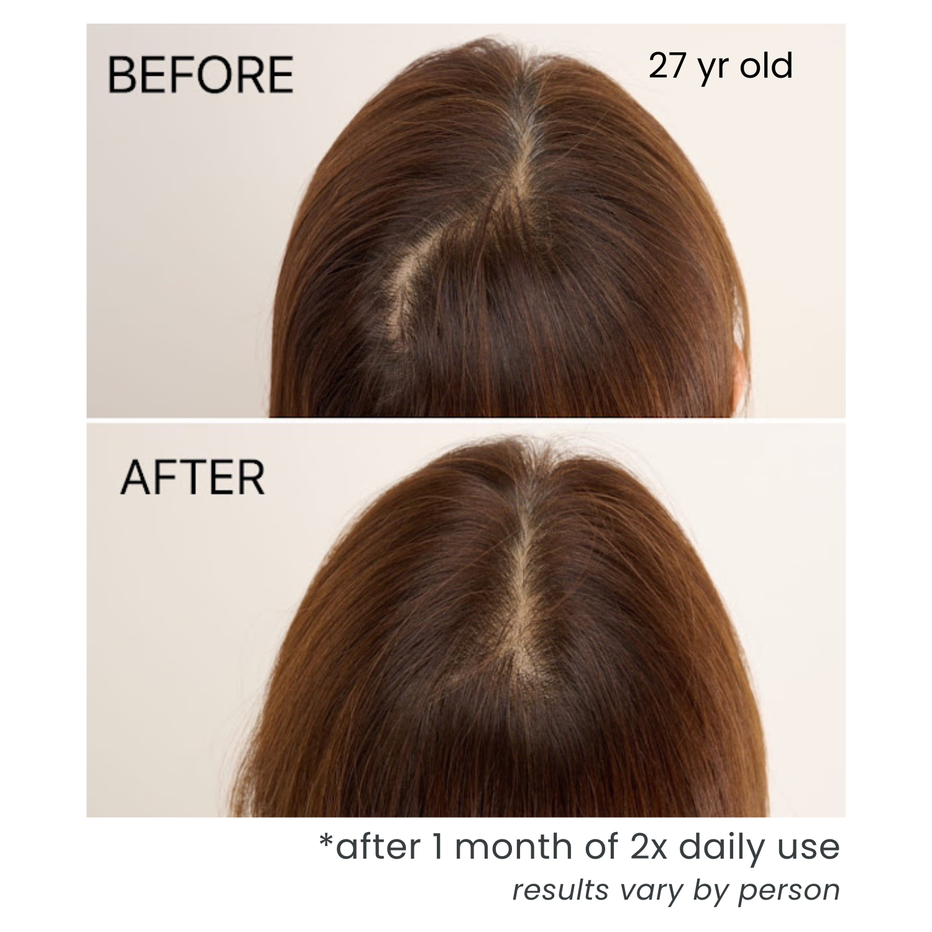 Zoom Expand image caption scalp serum