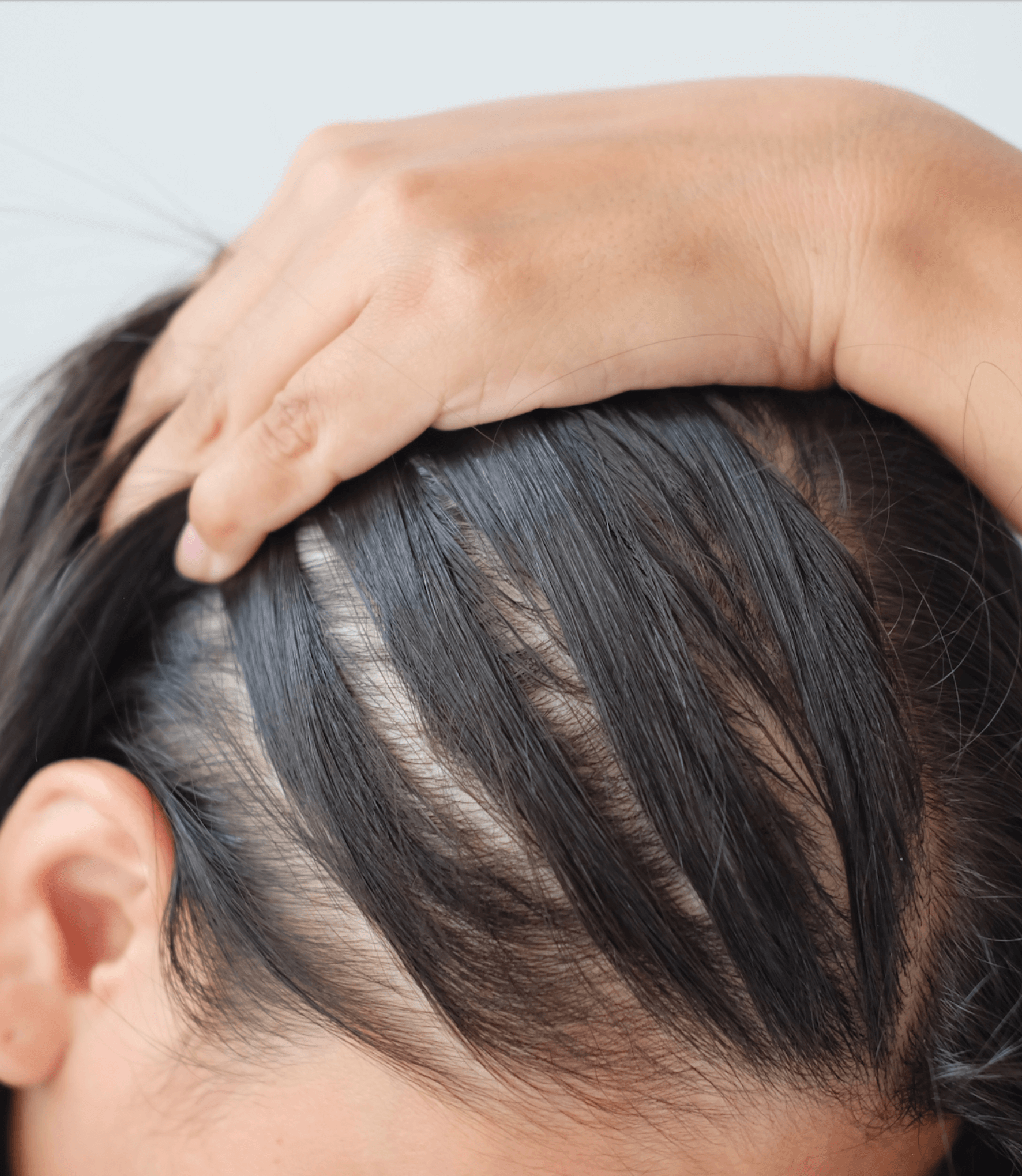Concern 4: increase in hair fall out?