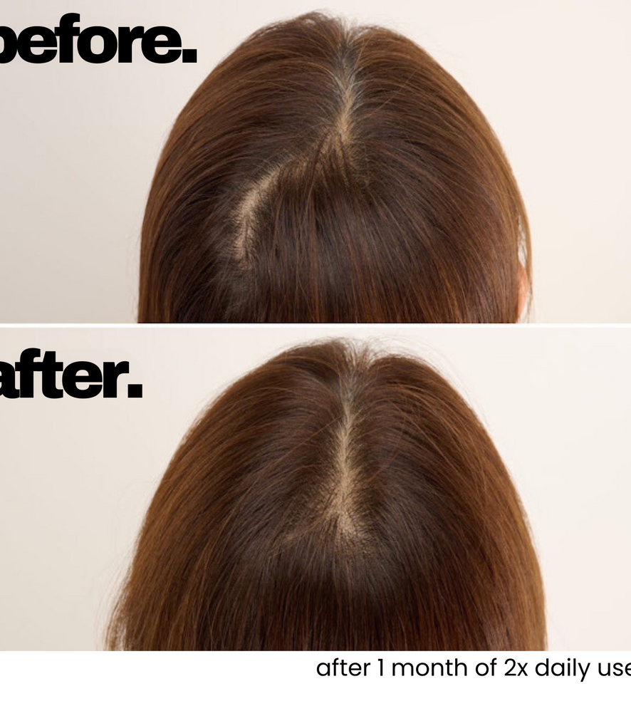 Root Beauté - KIWABI